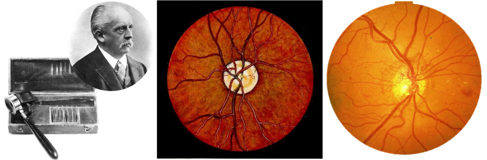 Optique adaptative pour l’imagerie rétinienne